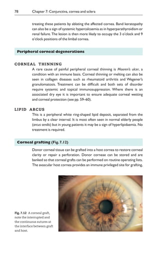 Lecture Notes on Ophthalmology.pdf