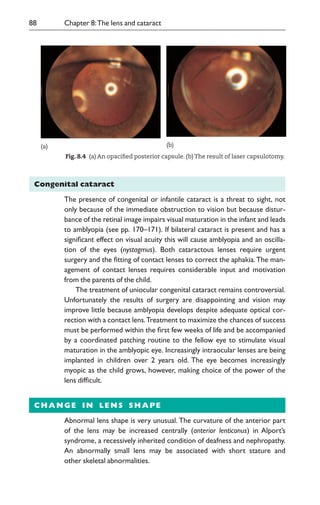 Lecture Notes on Ophthalmology.pdf