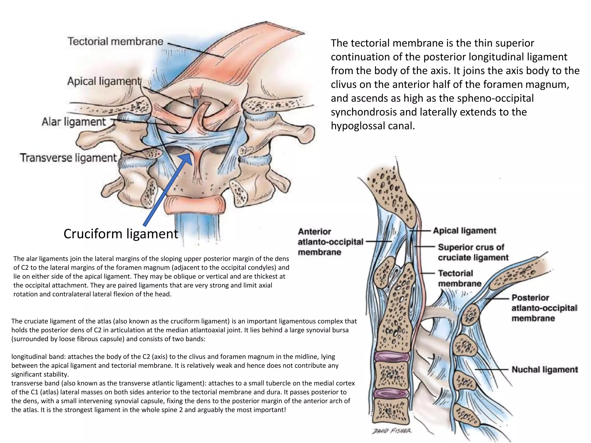 Odontoid fractures in the elderly | PPTX