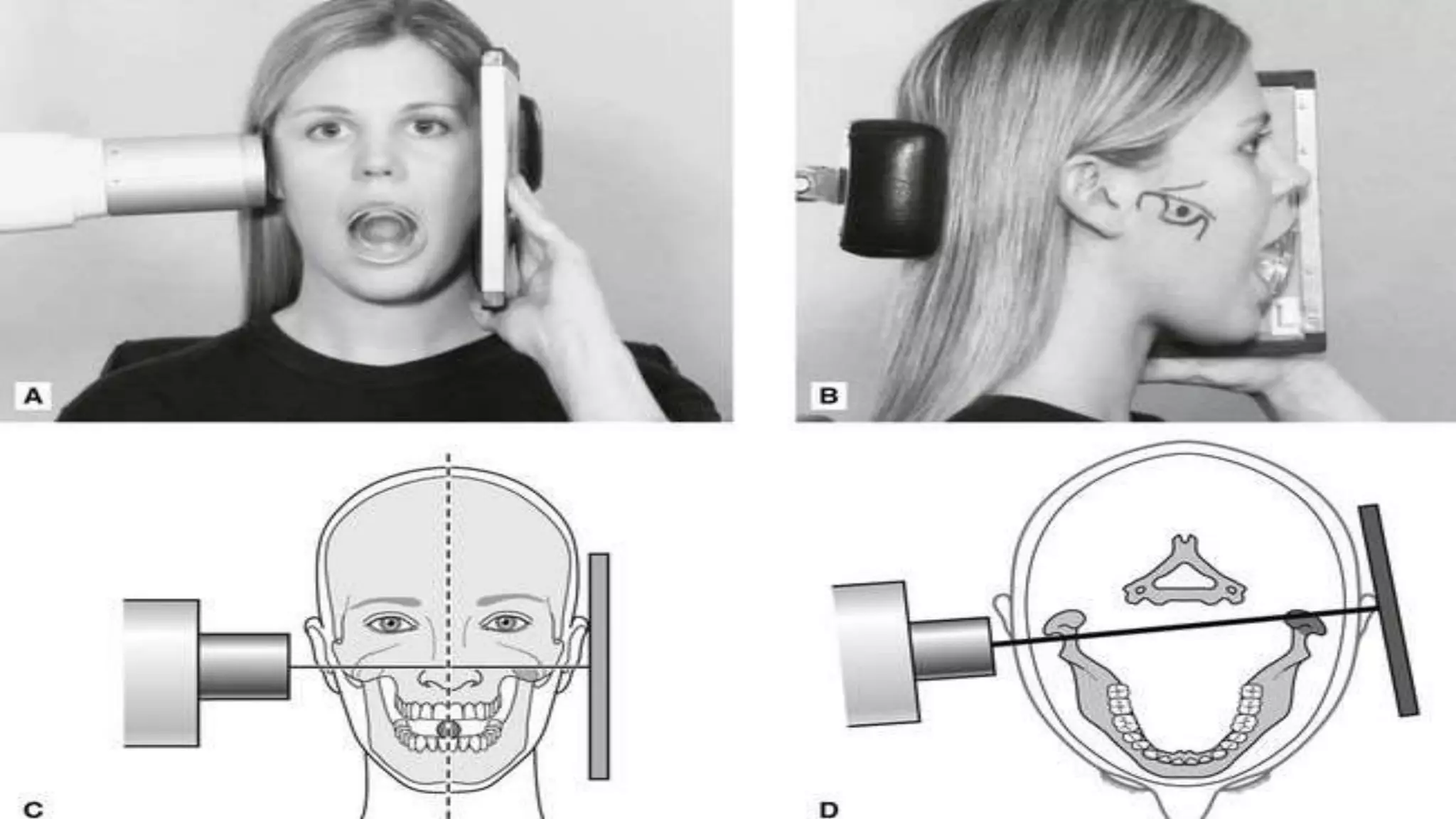 Lecture of tmj | PPTX