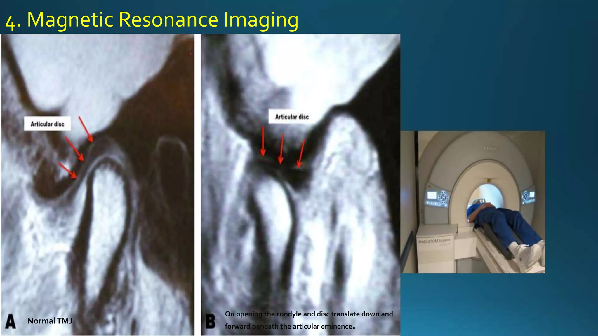 Lecture of tmj | PPTX