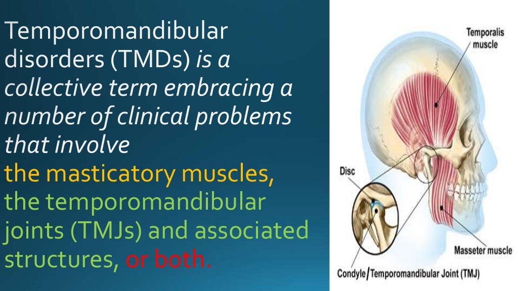 Lecture of tmj