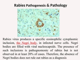 Lecture of Virology (Rabies)with Audio.ppt