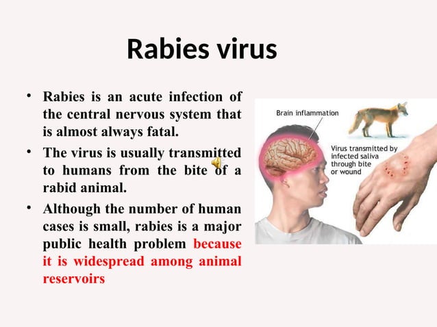 Lecture of Virology (Rabies)with Audio.ppt