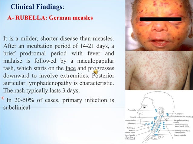 lecture of virology (Rubella) with Audio.ppt