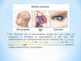 lecture of virology (Rubella) with Audio.ppt