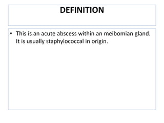 Lecture on Blepharitis , Stye & Chalazion For 4th Year MBBS ...