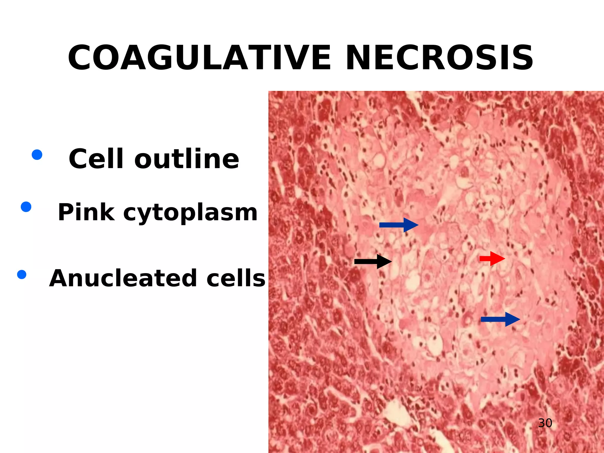 Principles of cell injury and cellular adaptation .ppt