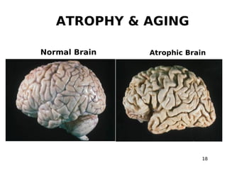 Principles of cell injury and cellular adaptation .ppt