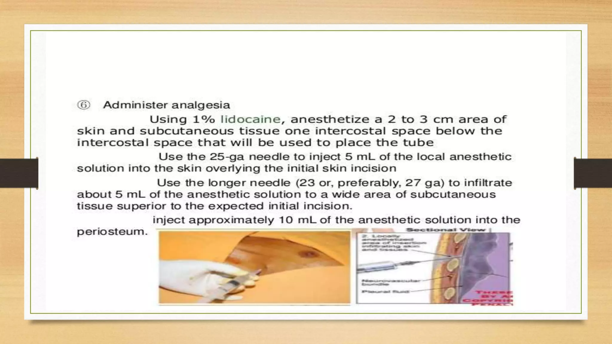 Lecture on chest tube insertion | PPTX