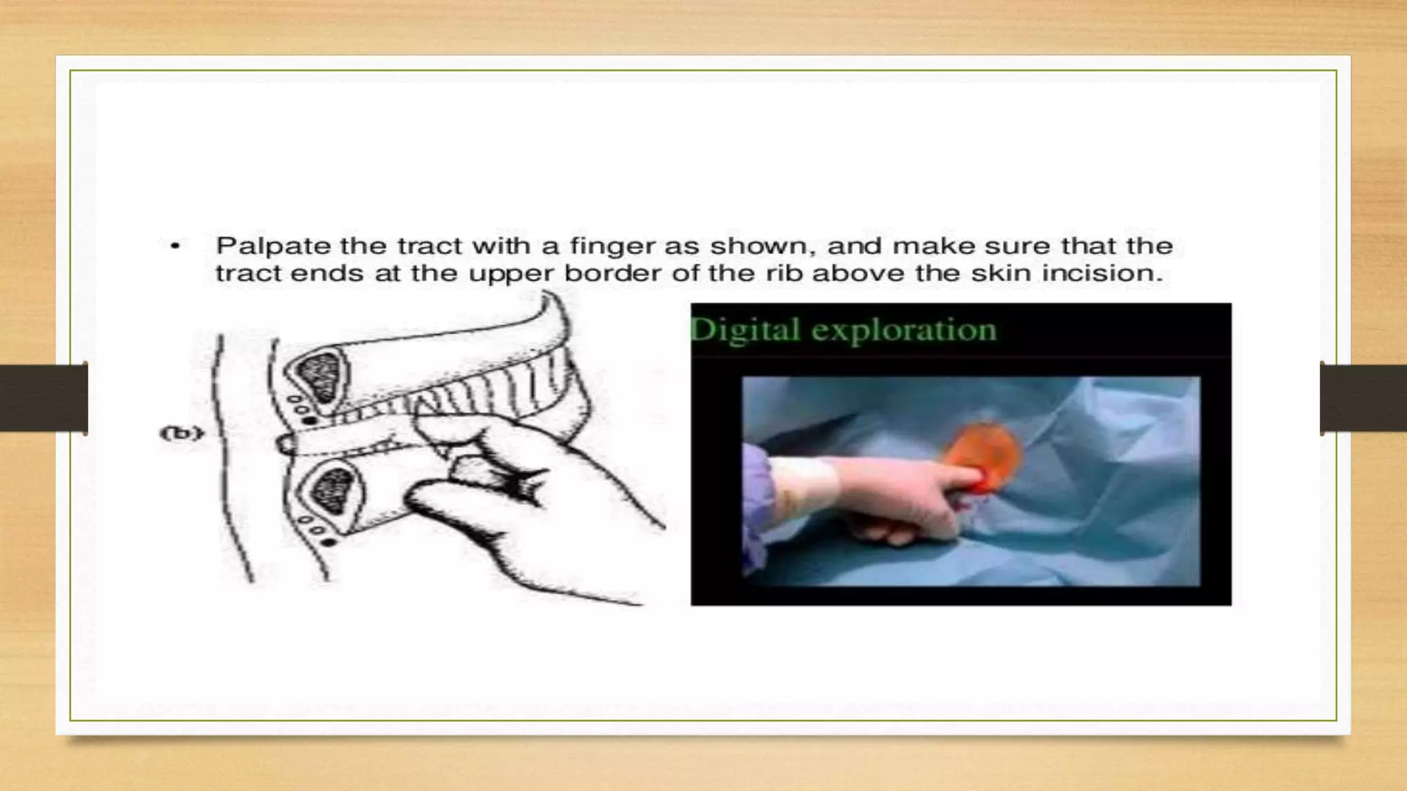 Lecture on chest tube insertion | PPTX