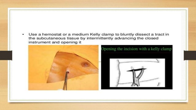 Lecture on chest tube insertion | PPTX