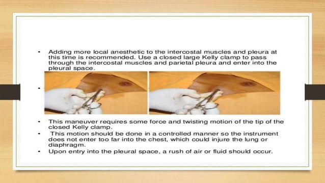 Lecture on chest tube insertion | PPTX