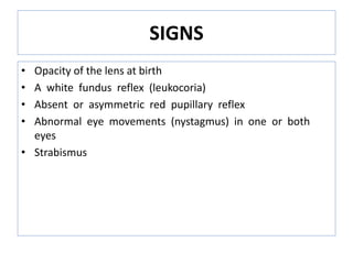 Lecture on Congenital Cataract For 4th Year MBBS Undergraduate Students ...
