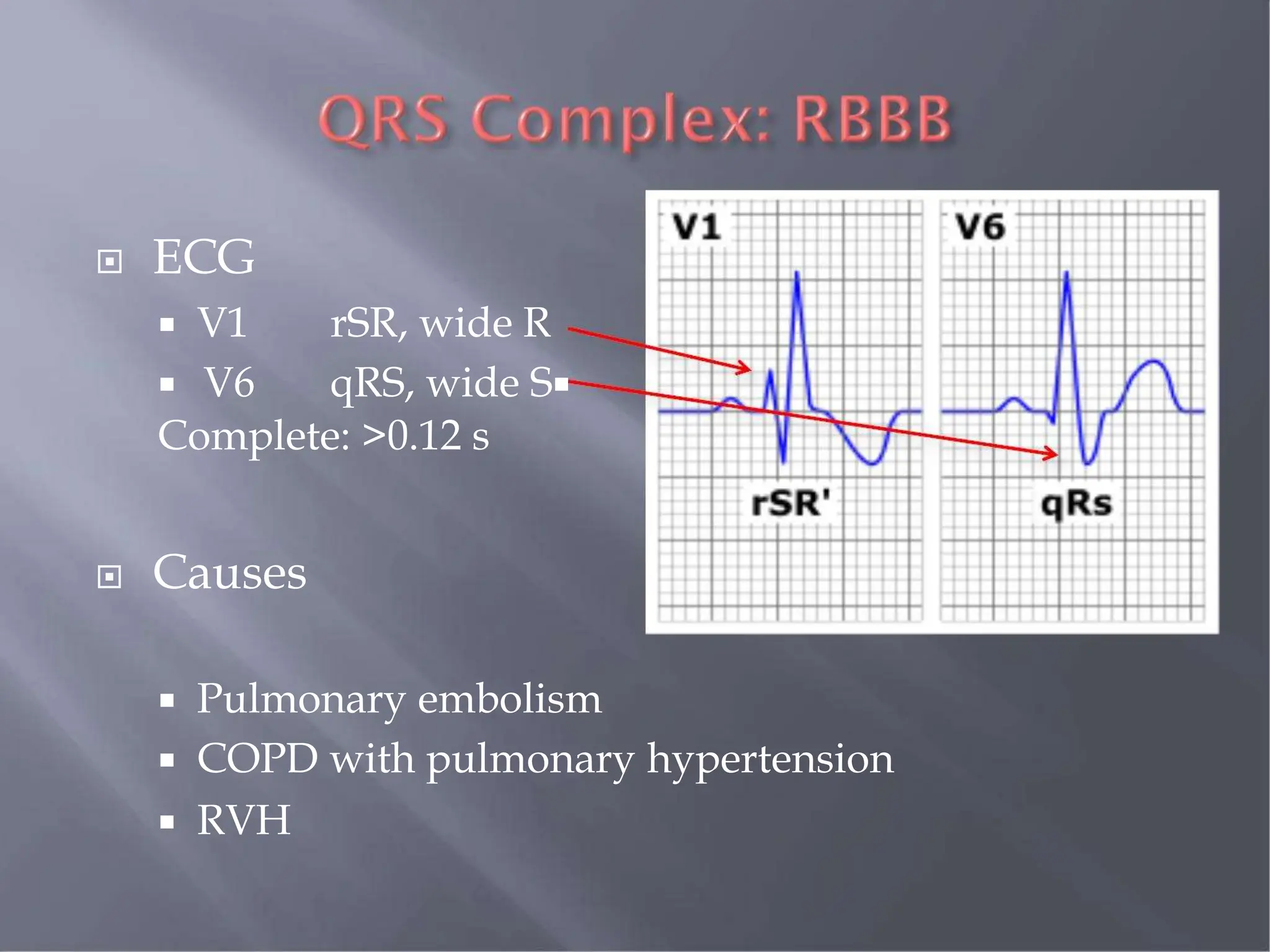 lecture one ecg.pptx hhhhhhhhhhhhhgyuuuhh | PPTX