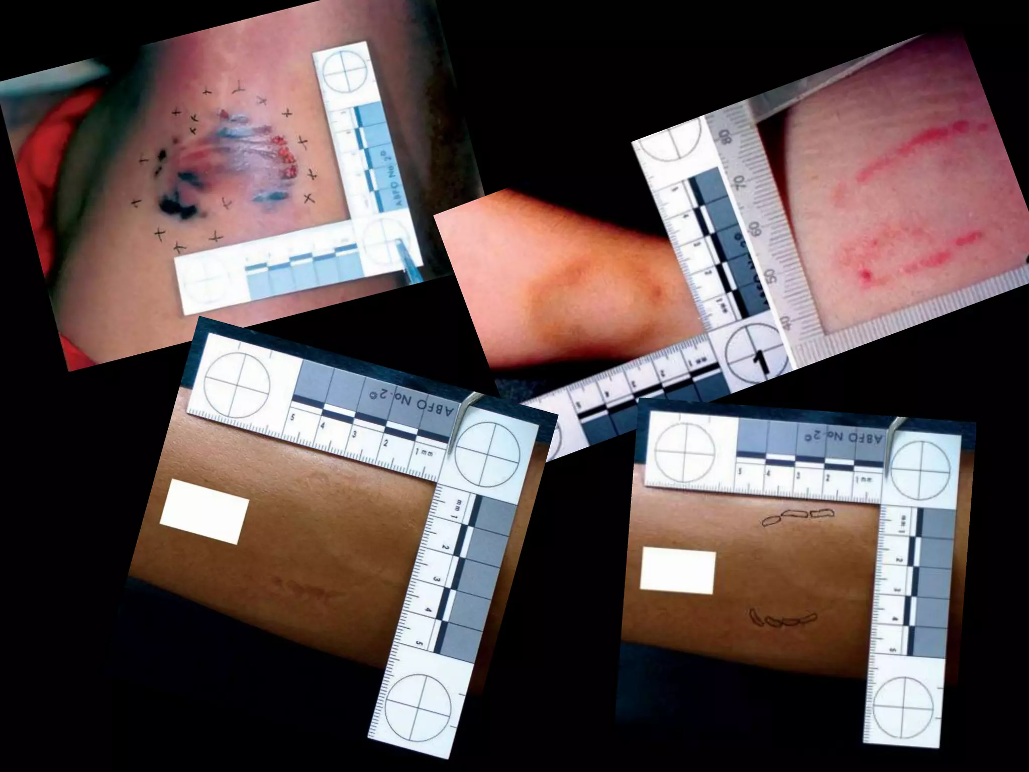 LECTURE ON FORENSICS.ppt