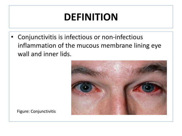 Lecture on Infective Conjunctivitis For 4th Year MBBS Undergraduate ...
