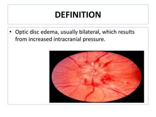 Lecture on Optic Neuritis & Papilledema For 4th Year MBBS Undergraduate ...