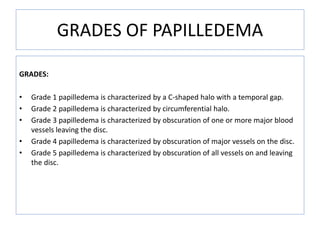 Lecture on Optic Neuritis & Papilledema For 4th Year MBBS Undergraduate ...