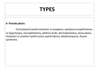 Lecture on Ptosis For 4th Year MBBS Undergraduate Students By Prof. Dr ...