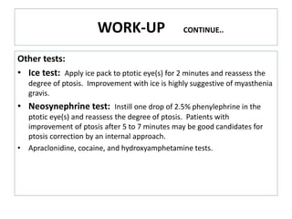 Lecture on Ptosis For 4th Year MBBS Undergraduate Students By Prof. Dr ...
