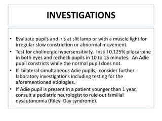 Lecture on Pupillary Reflexes; Common Abnormalities For 4th Year MBBS ...