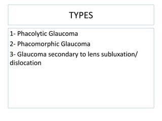 Lecture on Secondary Glaucoma Due to Hypermature Cataract For 4th Year ...