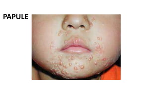 LECTURE ON SKIN DISEASES.pptx