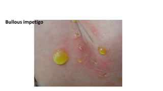 LECTURE ON SKIN DISEASES.pptx