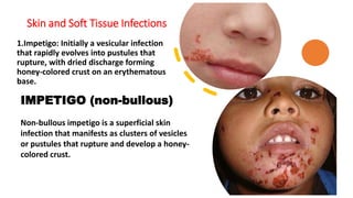 LECTURE ON SKIN DISEASES.pptx