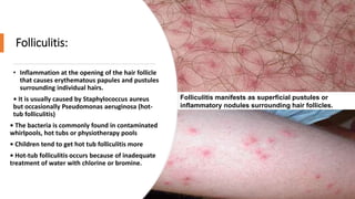 LECTURE ON SKIN DISEASES.pptx