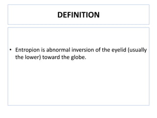 Lecture on Trichiasis, Entropion & Ectropion For 4th Year MBBS ...