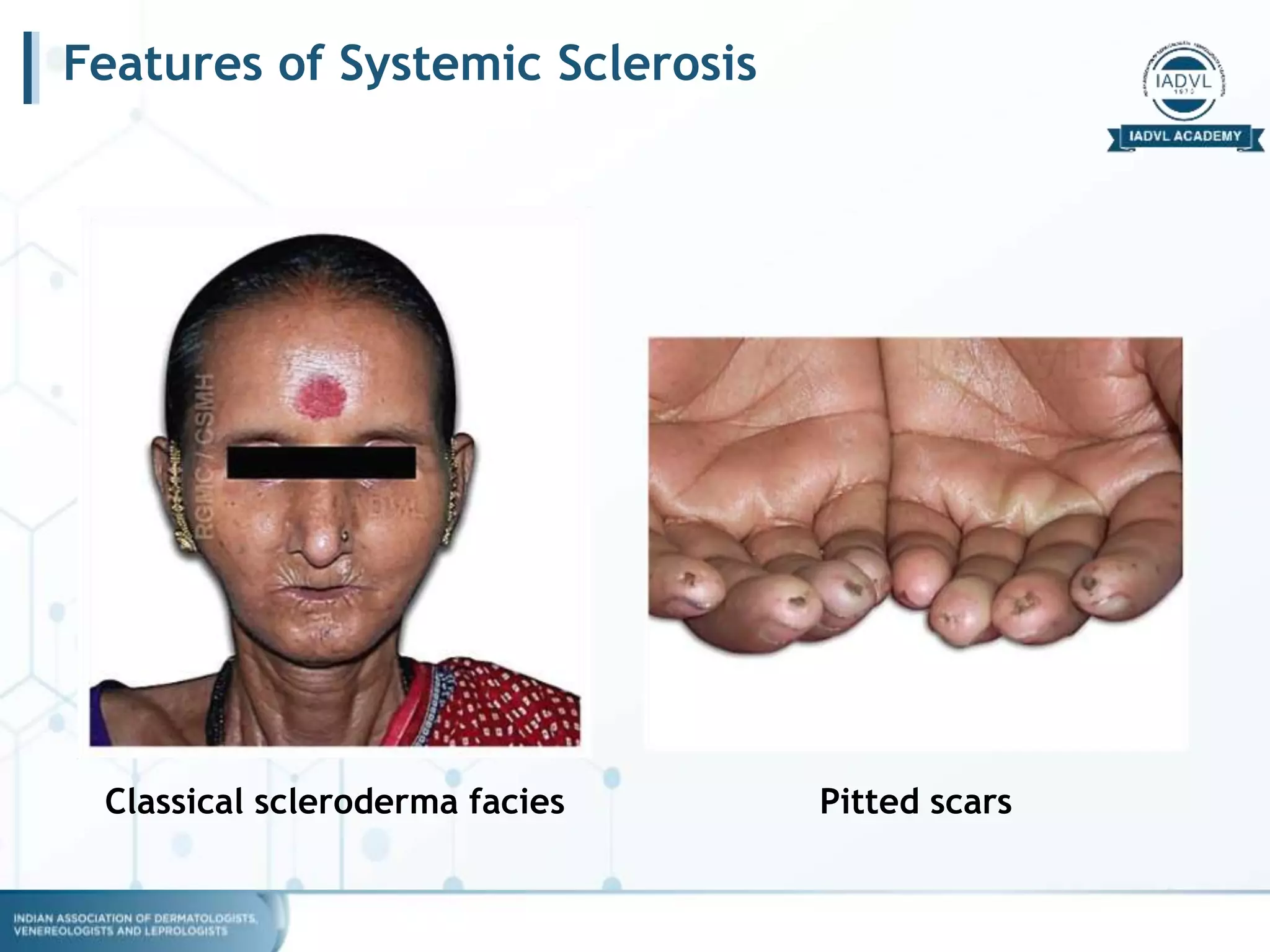 Lecture physiotherapy.pptx