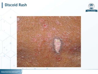 Lecture physiotherapy.pptx