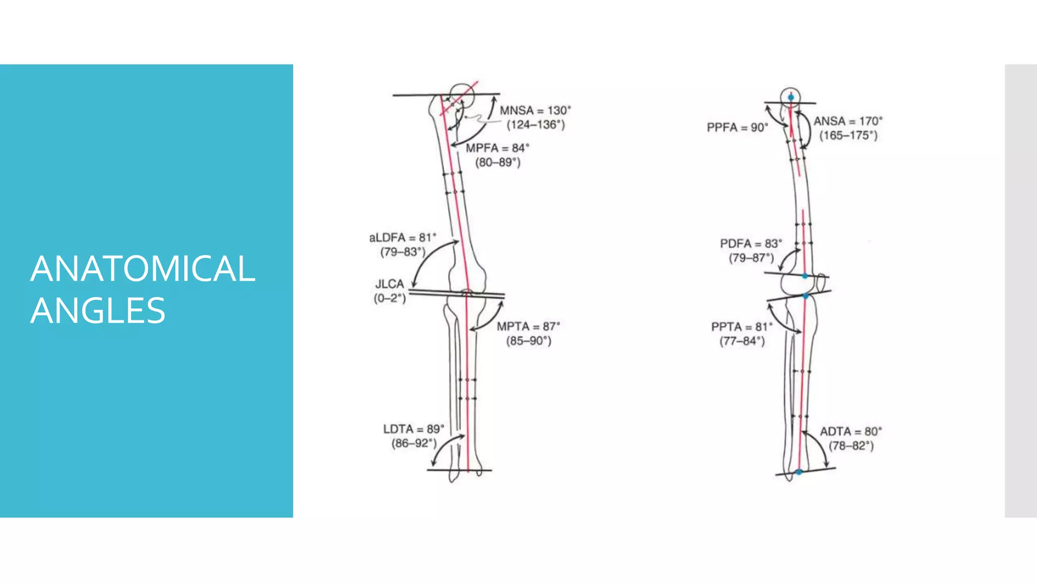 fractures of proximal tibia.pptx