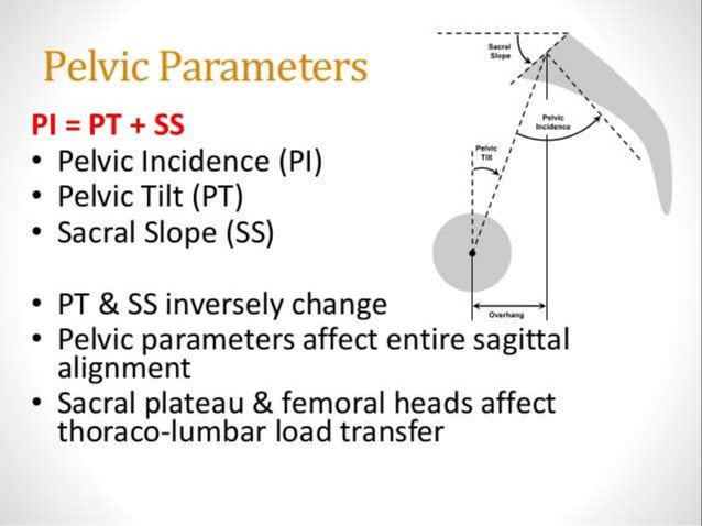 spine Lecture pso | PPT