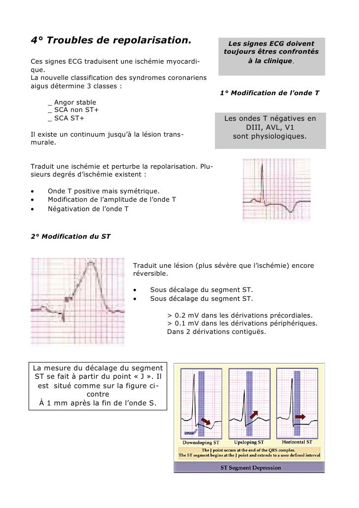 Lecture rapide de l’ecg amis med.com