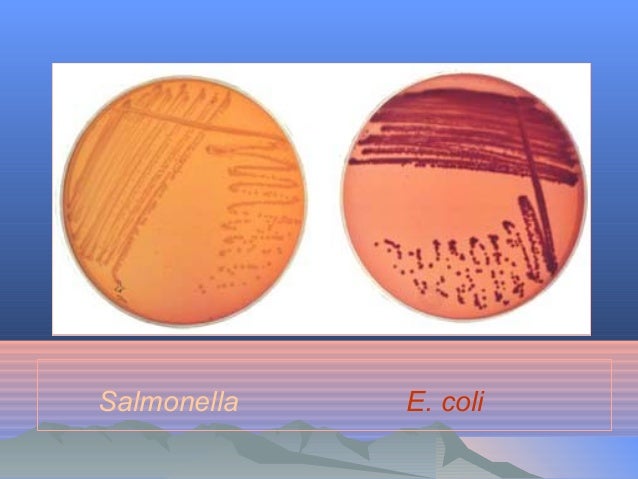 Lectures 15-17-Escherichia coli, Shigella, Salmonella
