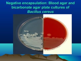 Bacillus Cereus Blood Agar