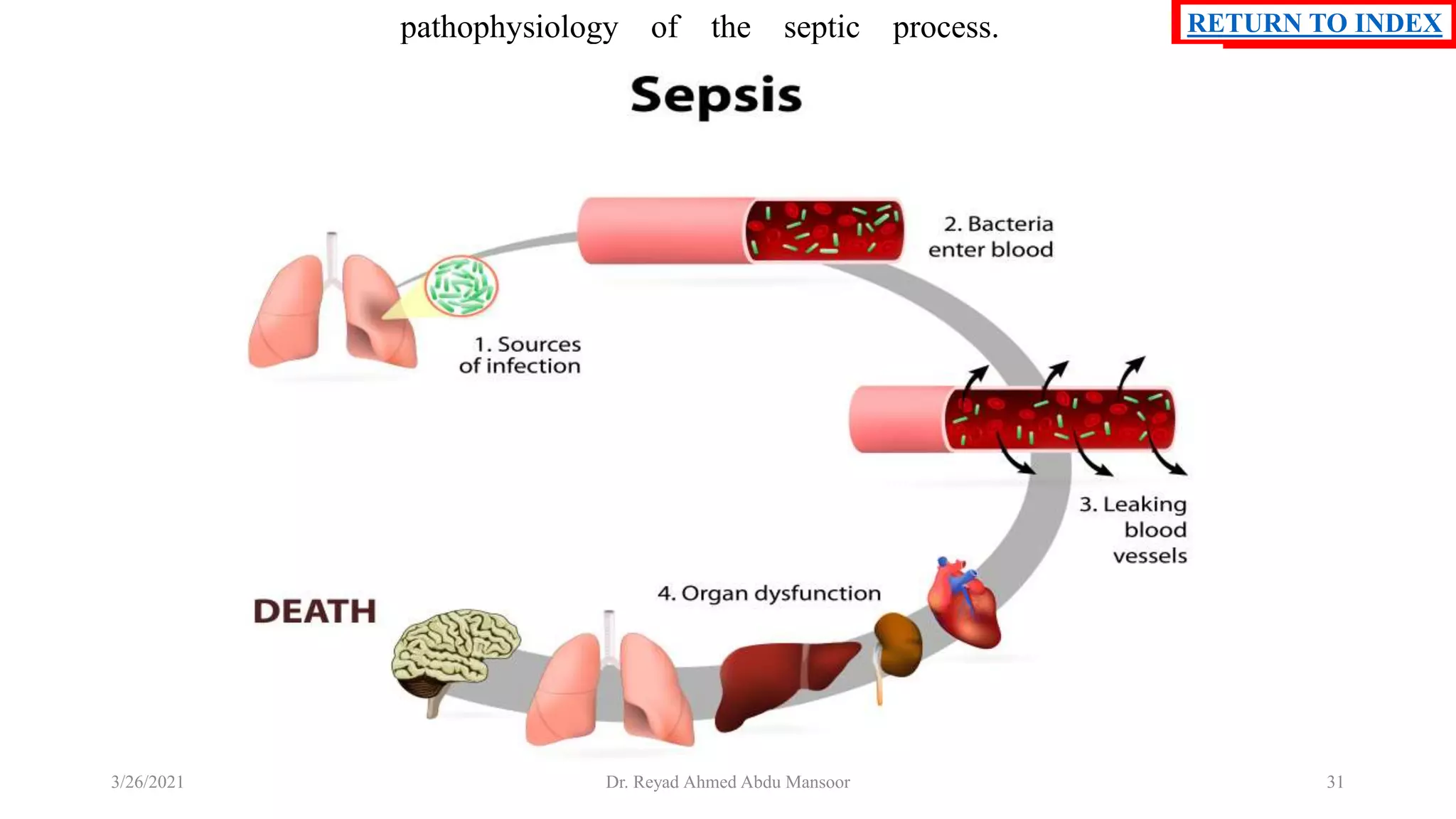 Lecture sepsis in children | PPTX