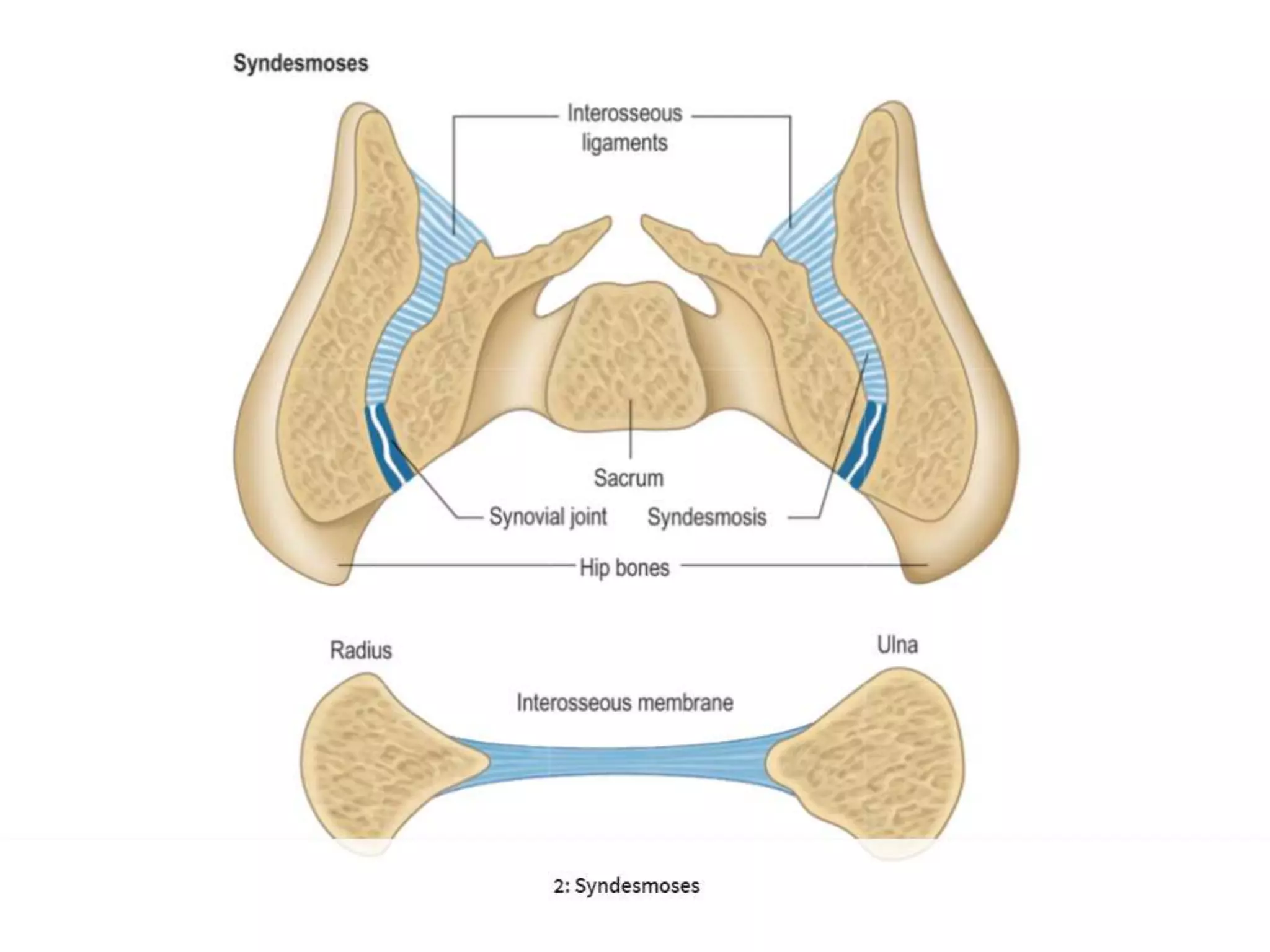 Sacroiliac Joint fusion | PPTX