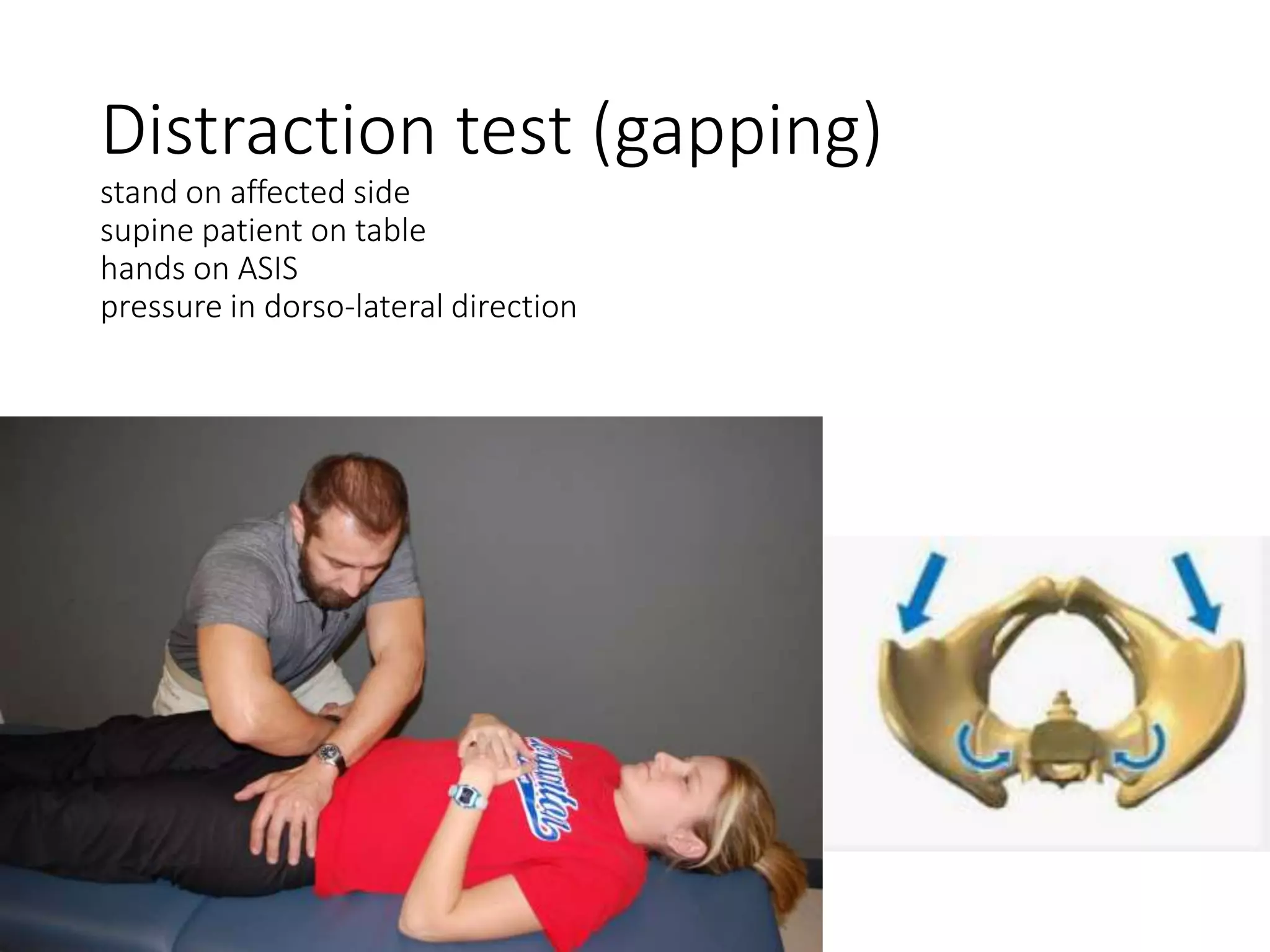 Sacroiliac Joint fusion | PPTX
