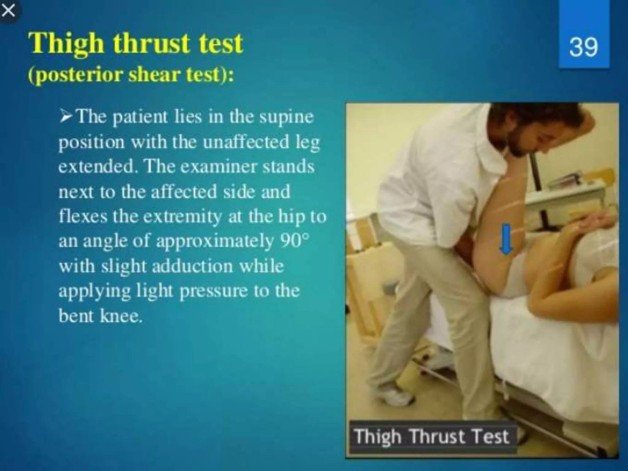 Sacroiliac Joint fusion | PPTX