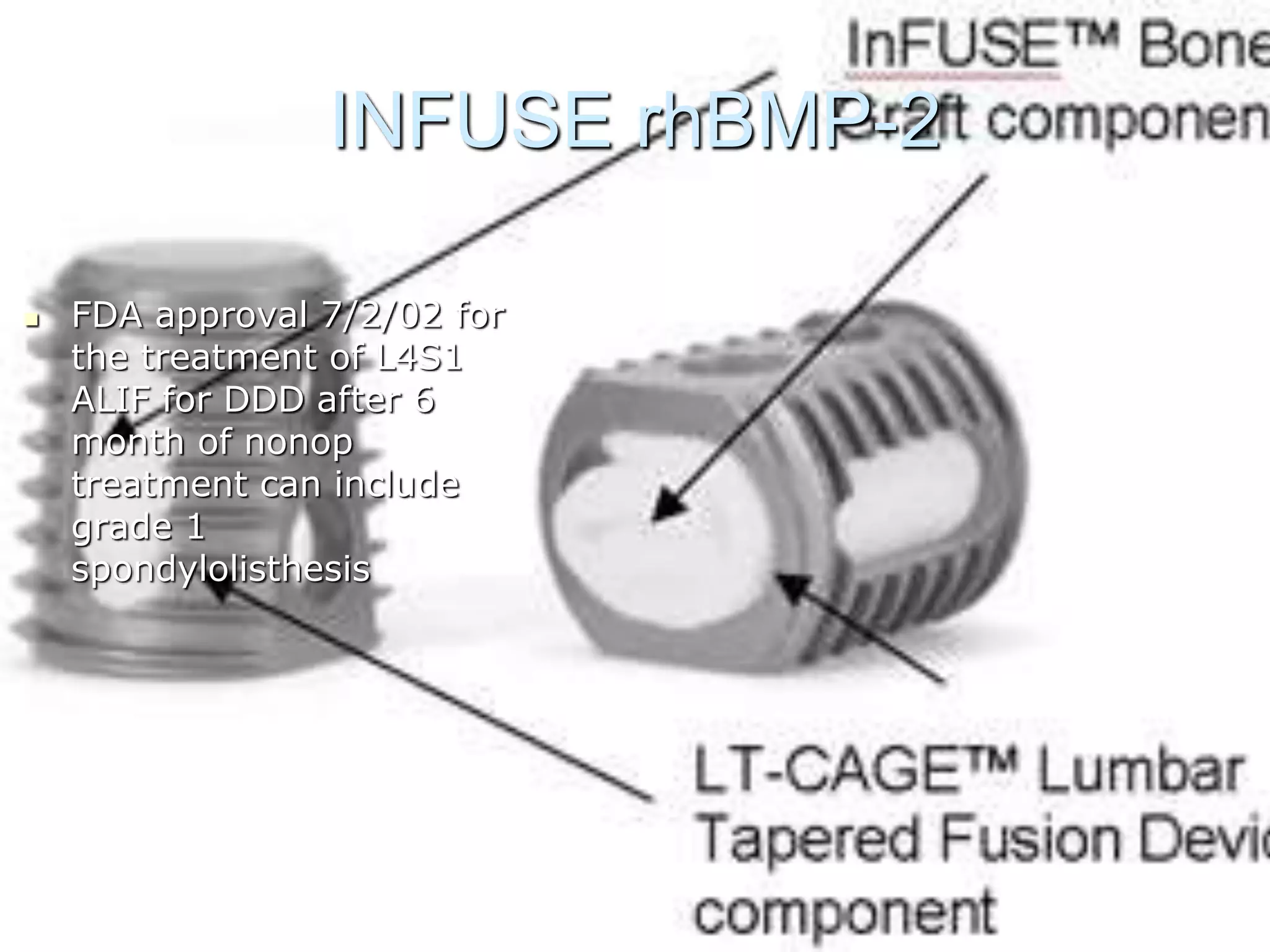 Lecture spine acdf nonunion repair 2018 | PPTX