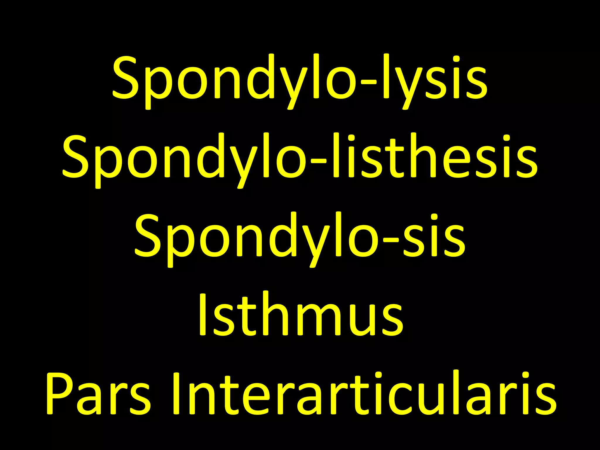 Lecture spondylolysis 2021 | PPTX