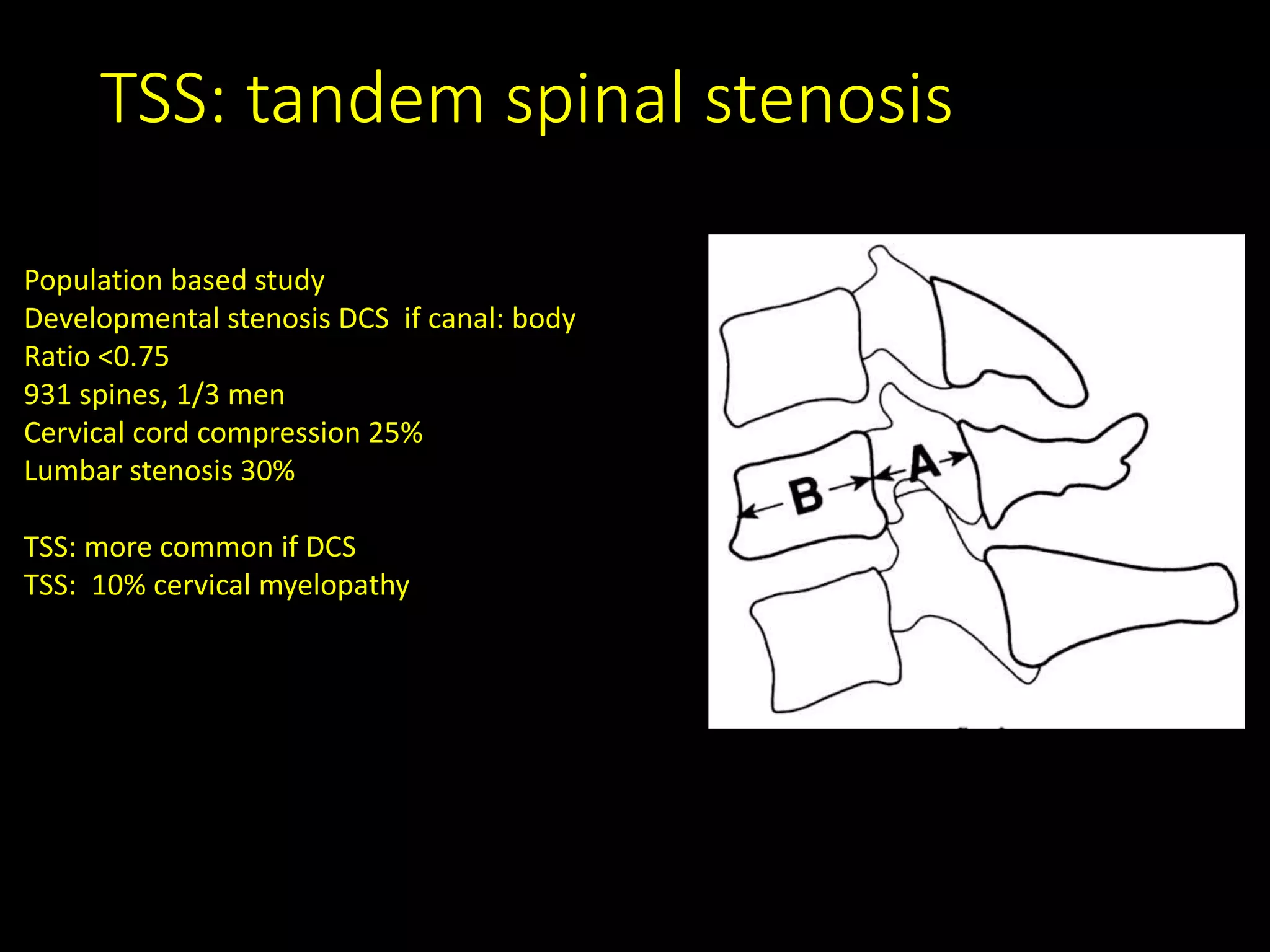 Spine Lecture tandem spinal stenosis 2019 | PPTX