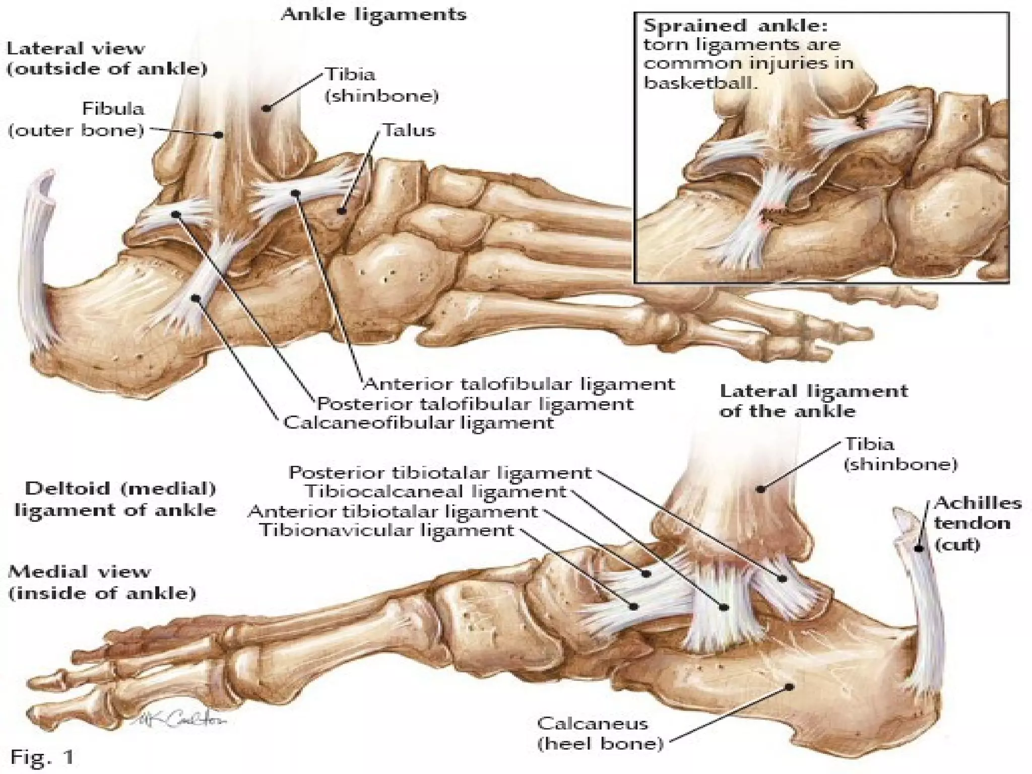 Lecture trauma ankle_fracture | PPT