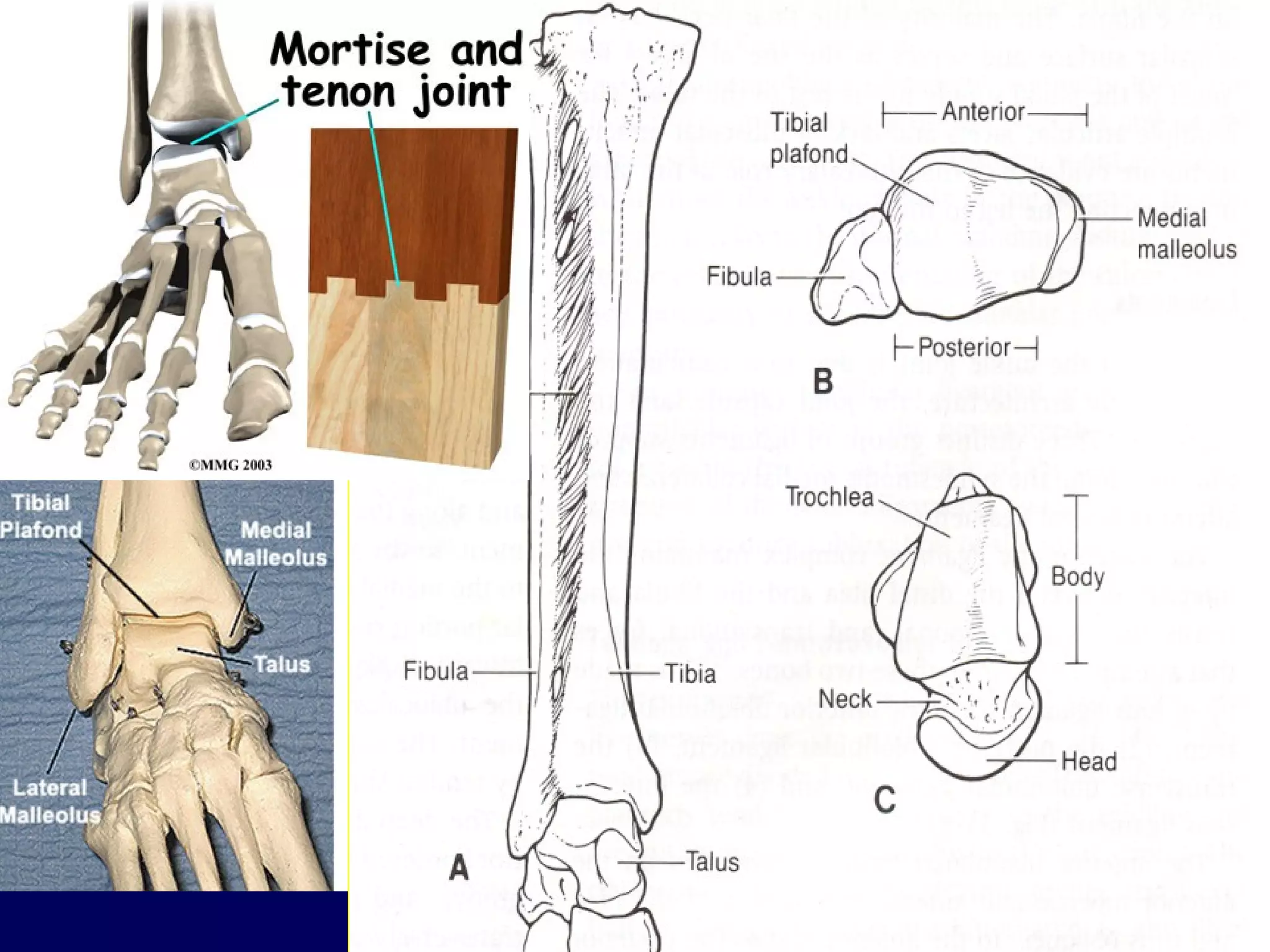 Lecture trauma ankle_tendon | PPT