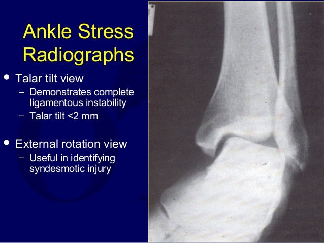 Lecture trauma ankle_tendon