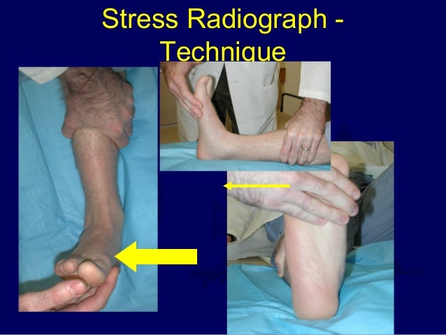 Lecture trauma ankle_tendon
